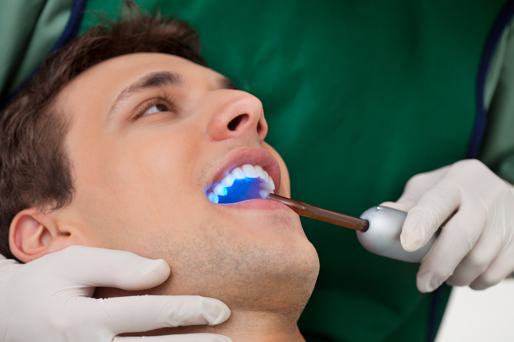 Sealants for Cavity Prevention - Smiles By Shields Dentistry